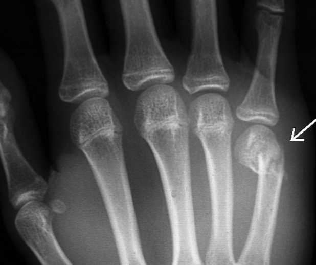 Hand - Katy Hand Surgery - Houston, TX